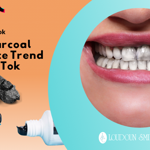 Dentists in Ashburn, VA | Loudoun Smile Center Dental Office